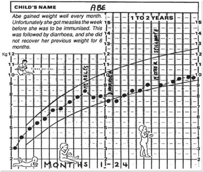 abe-chart - Children for Health